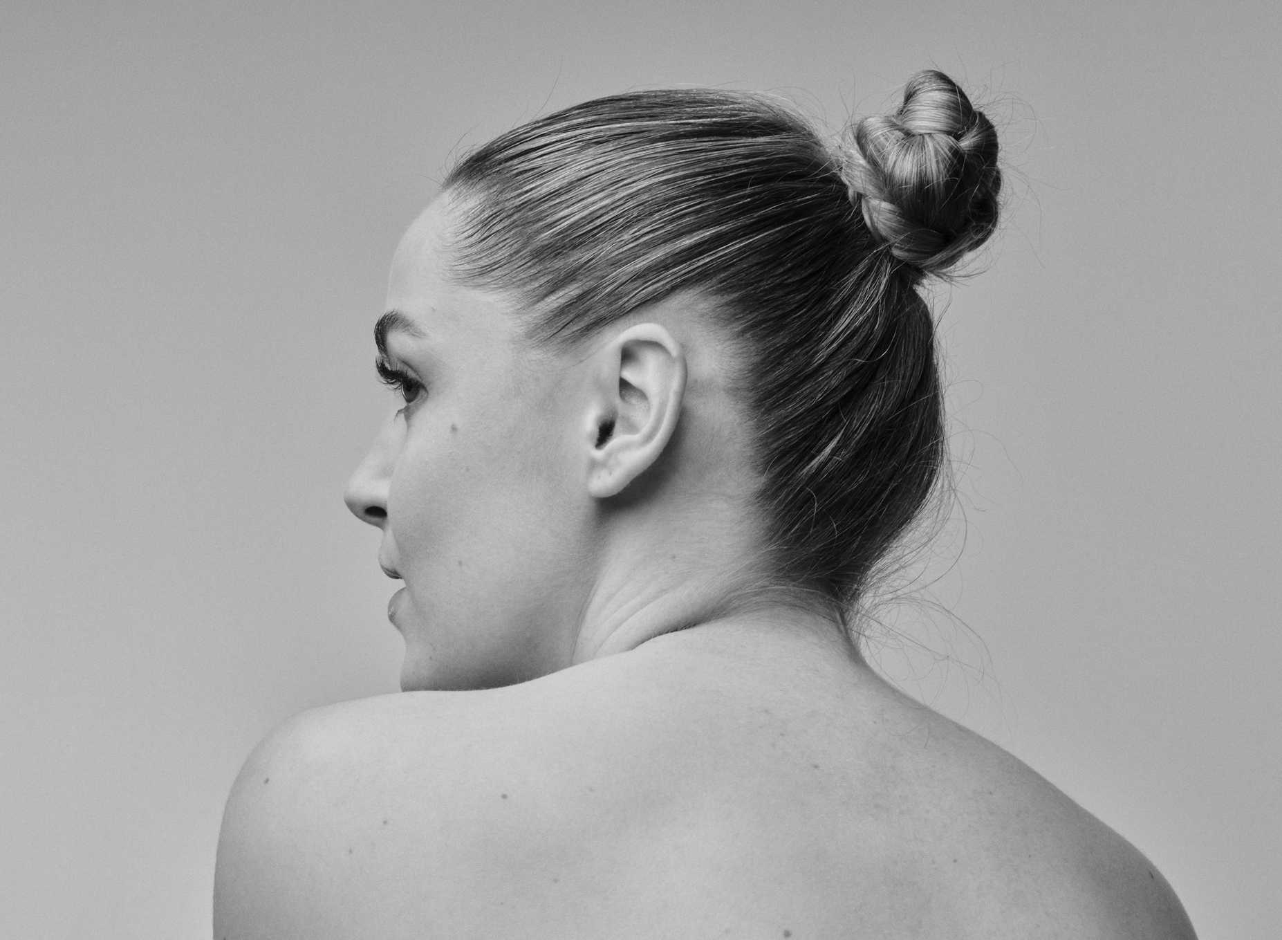 Otoplastie Lausanne | Opération des oreilles | Amiia